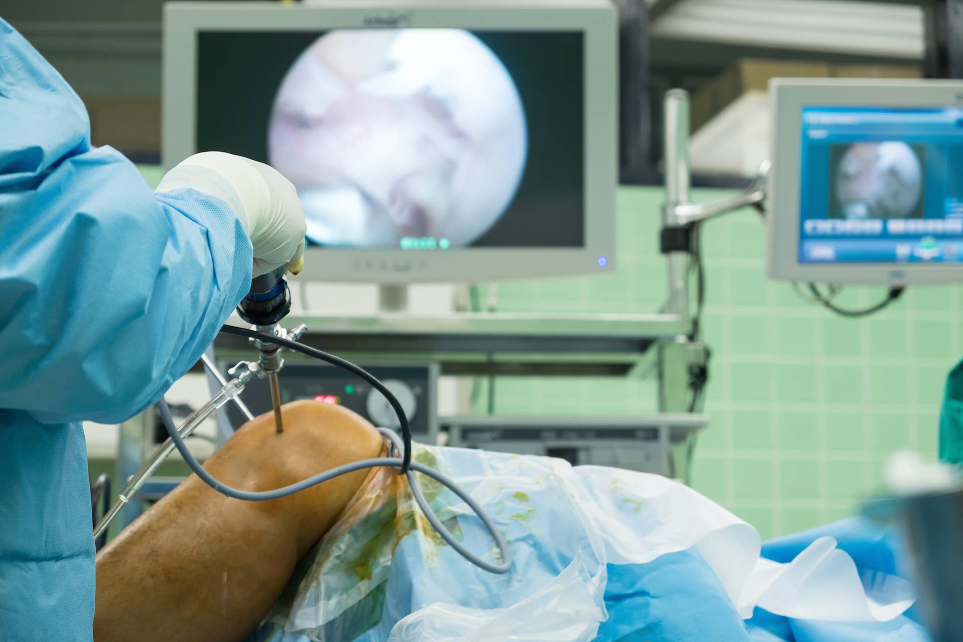 How to Deal with an ACL Tear: Prevention, Surgery and Expert Rehab Tips ...