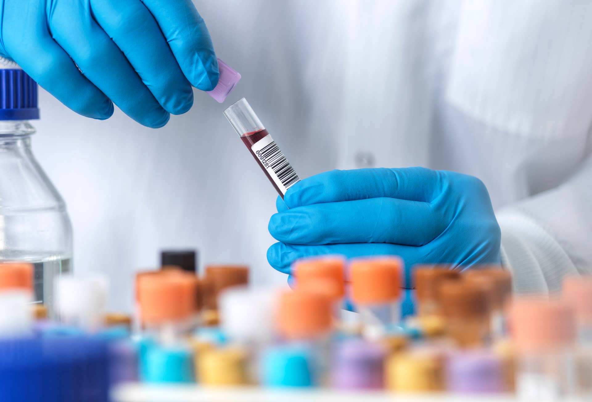 Scientists Discover New Blood Type, But There’s a Catch - Men's Journal