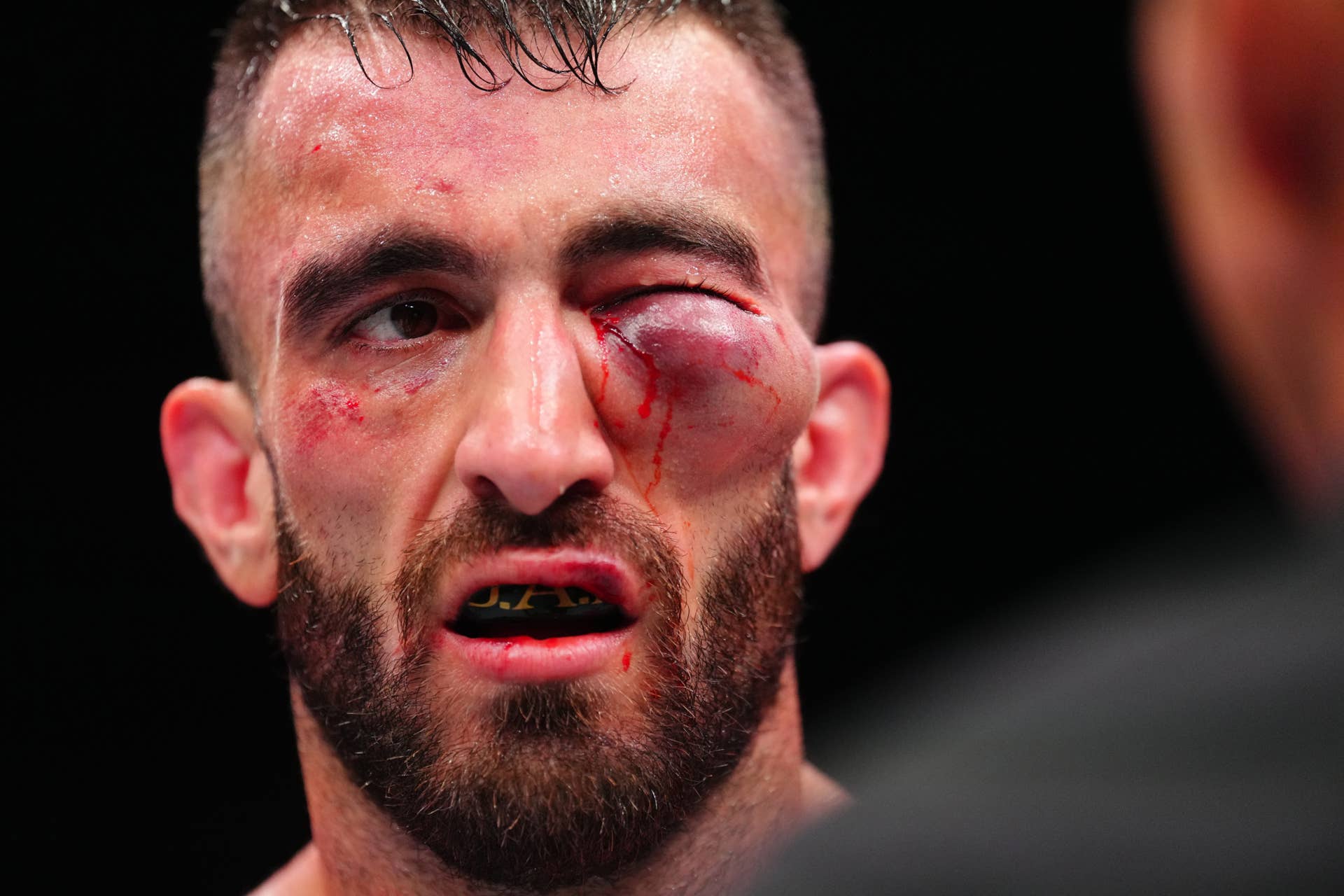 UFC Fighter's Gruesome Eye Injury Gets Surprising Update - Men's Journal