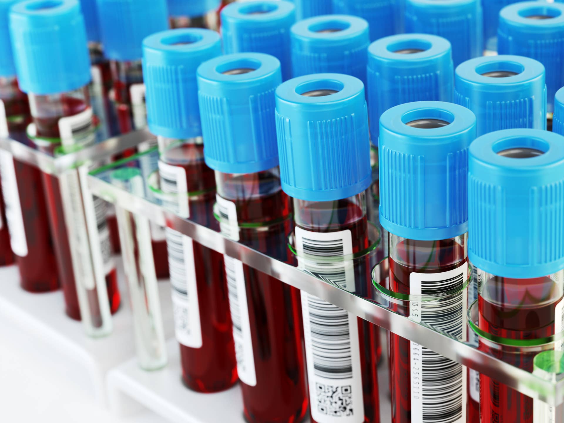 Blood Tests Can Now Spot Alzheimer's Changes. Here's What Doctors Want ...