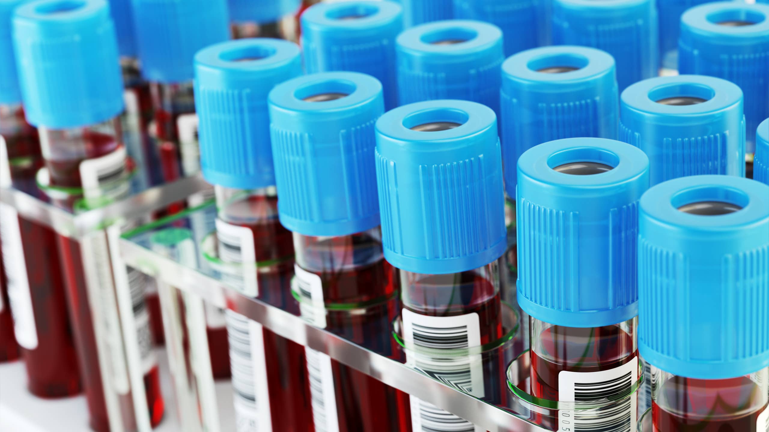 Blood Tests Can Now Spot Alzheimer's Changes. Here's What Doctors Want ...