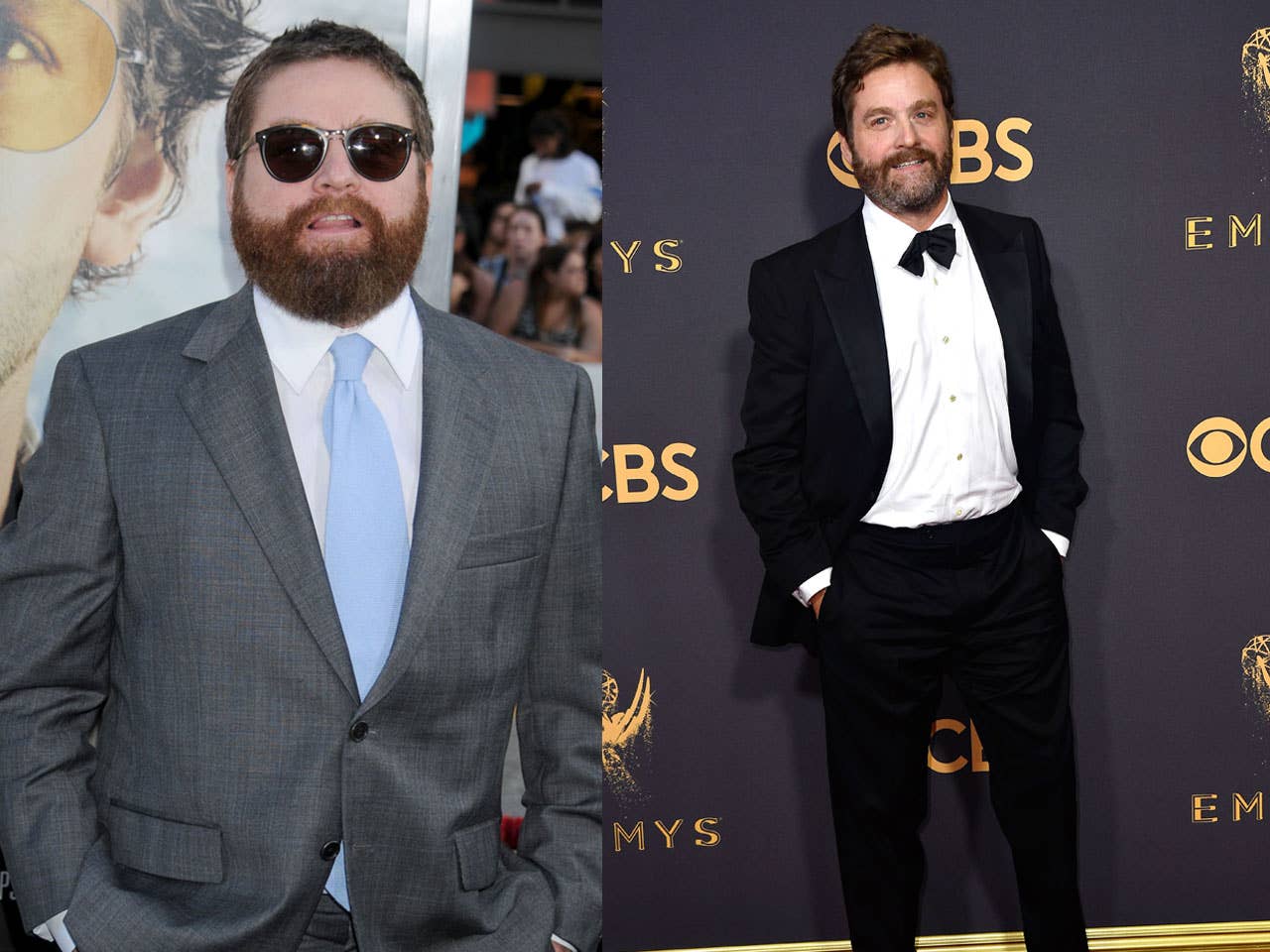 Zach Galifianakis Weight Loss 11 Photos Of The Actors Lean New Look