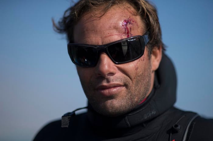 Surfer Nathan Fletcher recalls near fatal wipeout in Chile