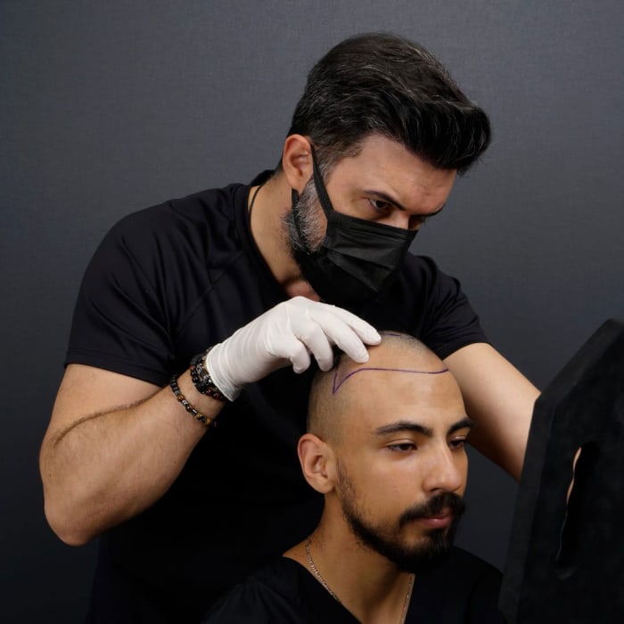 A Guide To Get Hair Transplant In Turkey Mens Journal