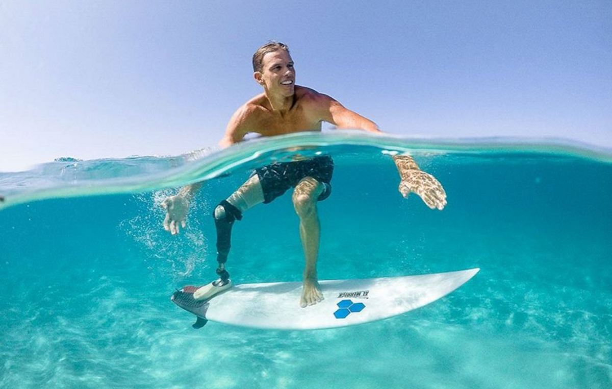 Surf photographer says tiger shark attack was a blessing