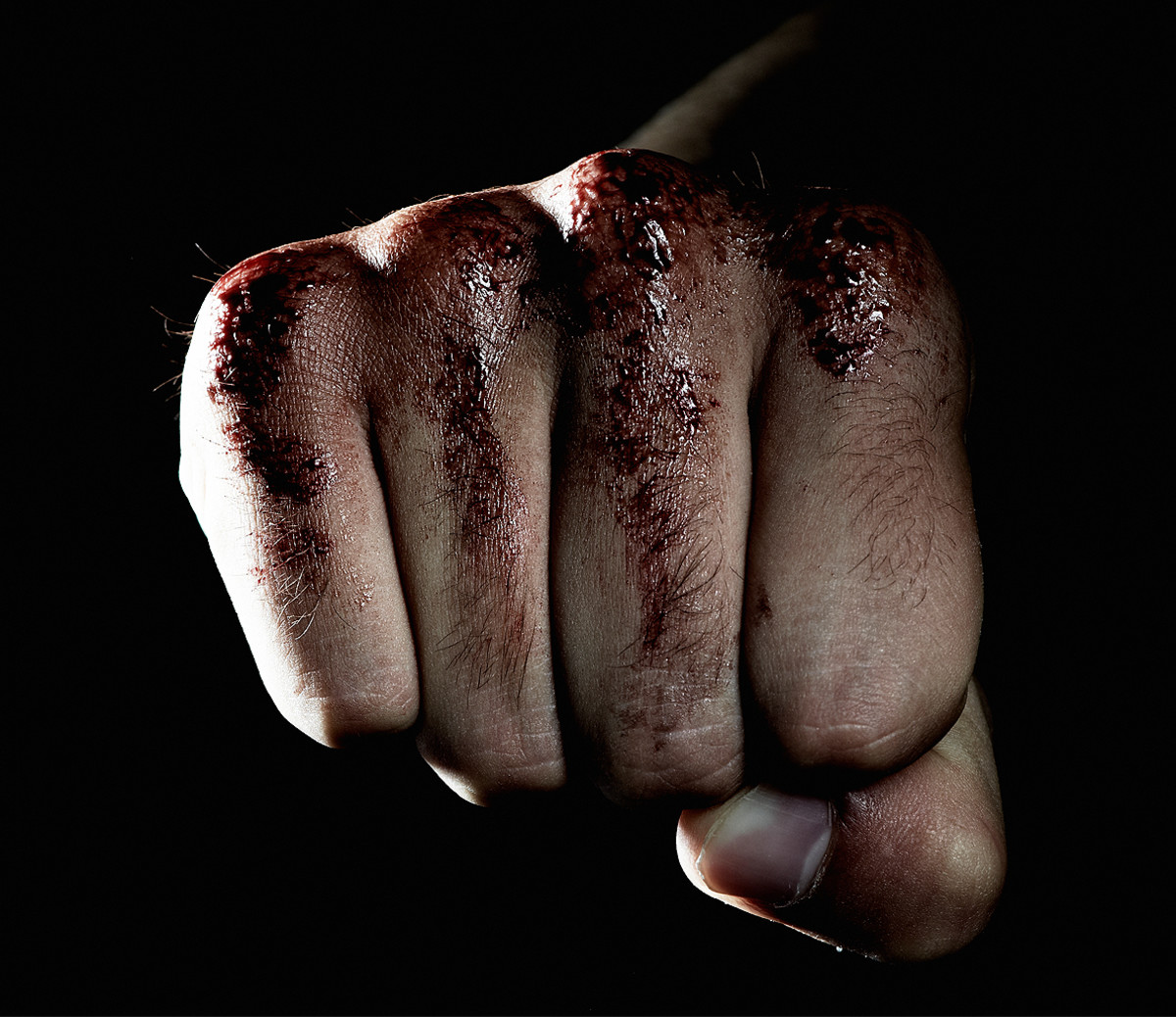 The 8 Most Common Sports Injuries