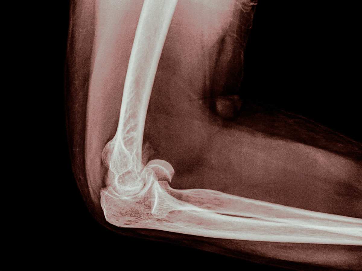 The 8 Most Common Sports Injuries - Men's Journal