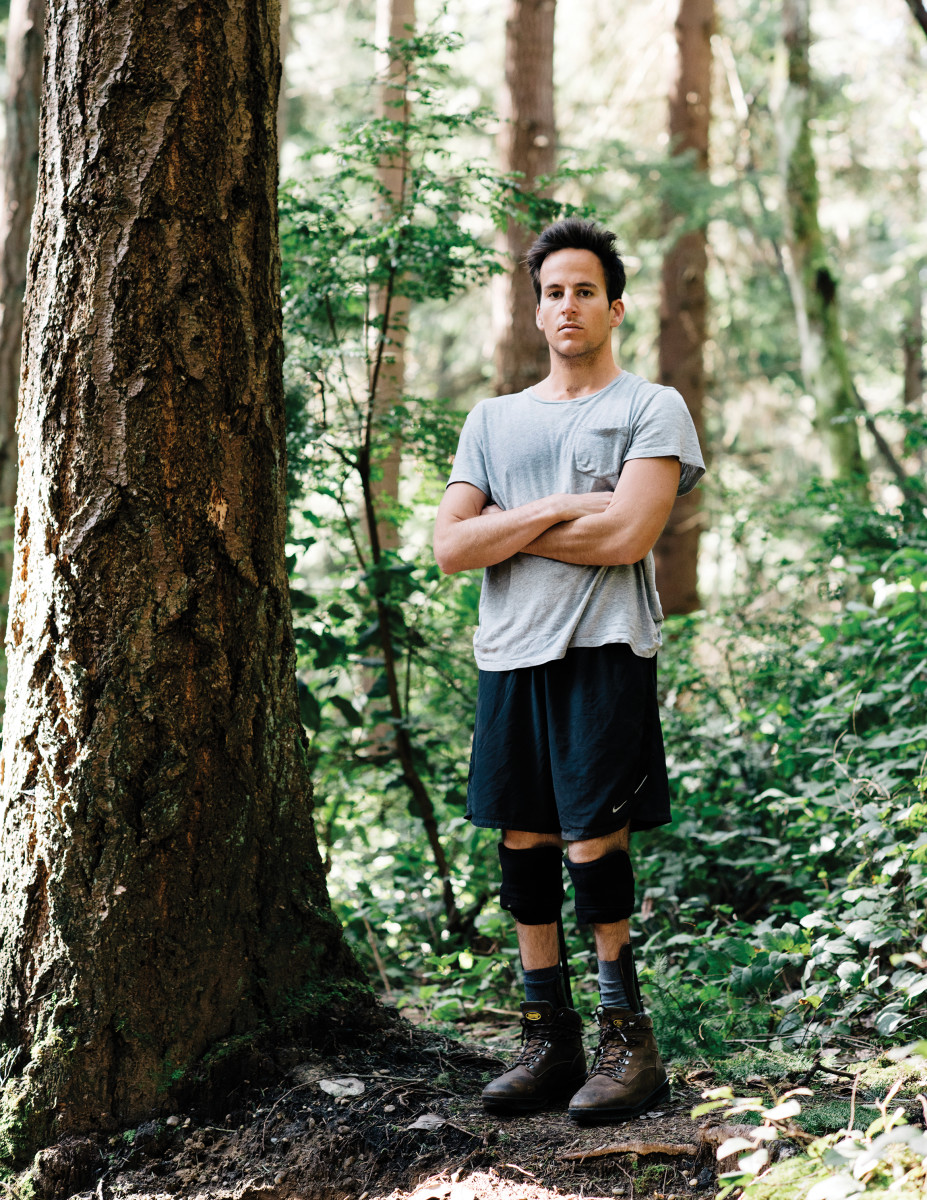 The Story of My Leg: ExoSym Leg Braces