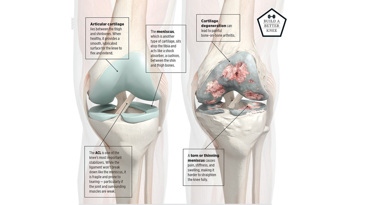 Why Good Knees Go Bad An Illustration Men s Journal why-good-knees-go-bad-an-illustration-men-s-journal