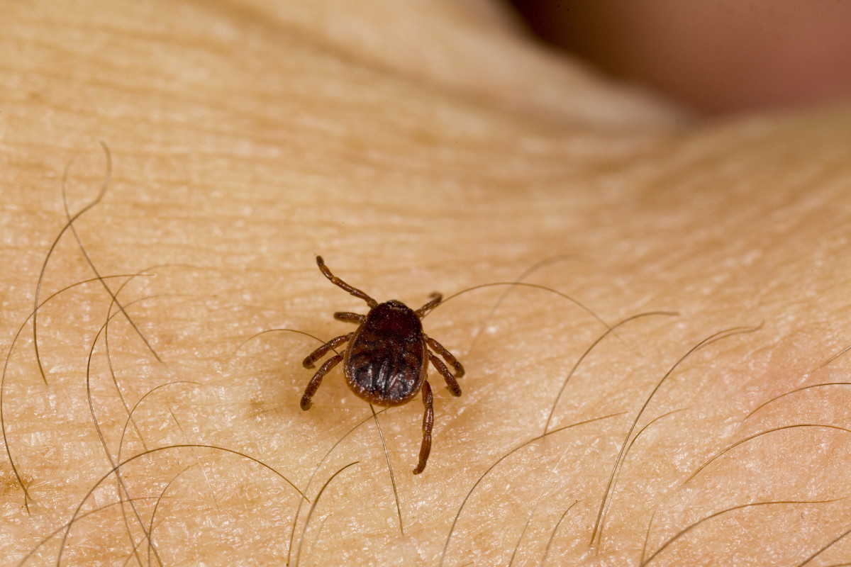 Lyme Disease Might Be Preventable With Human Sweat, New Study Finds