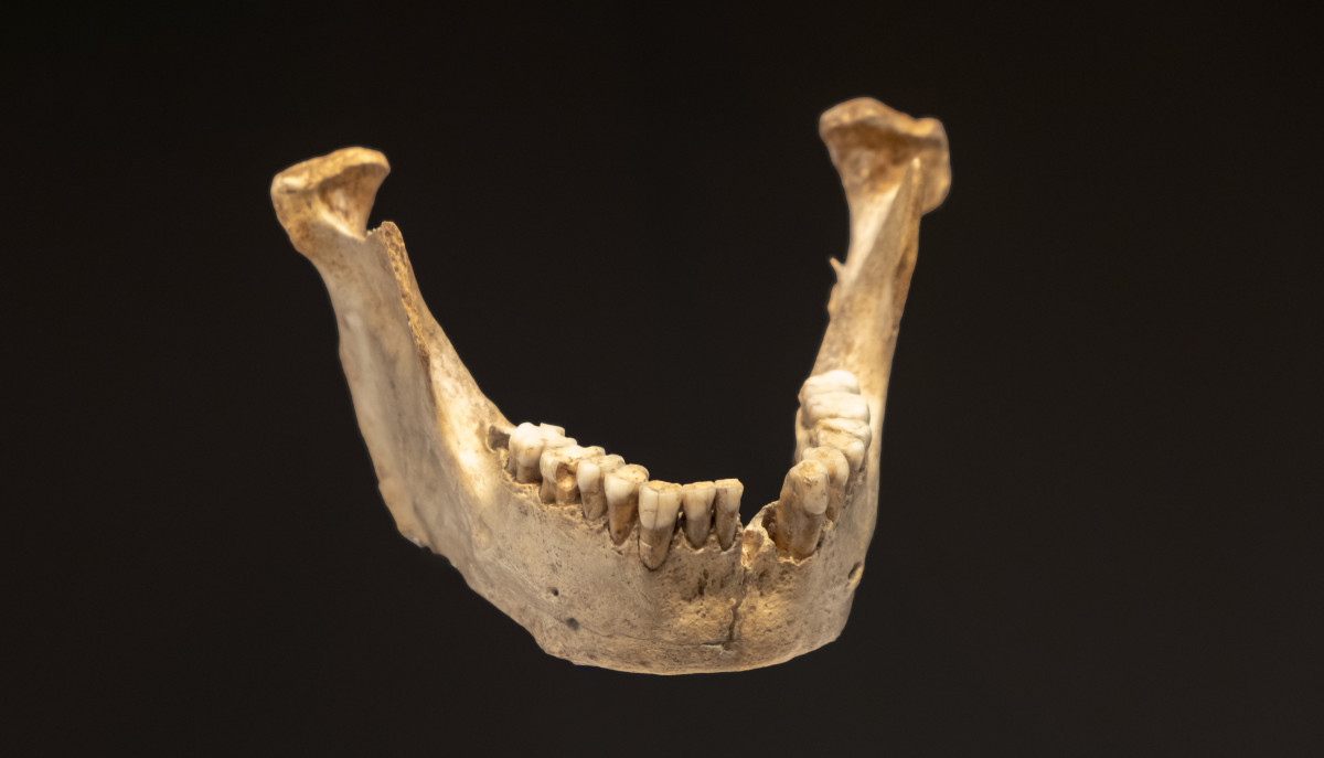 Dental Remains Reveal Odd Mating Habits of Early Humans
