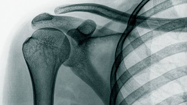 Build Strong Bones With These Six Tips - Men's Journal