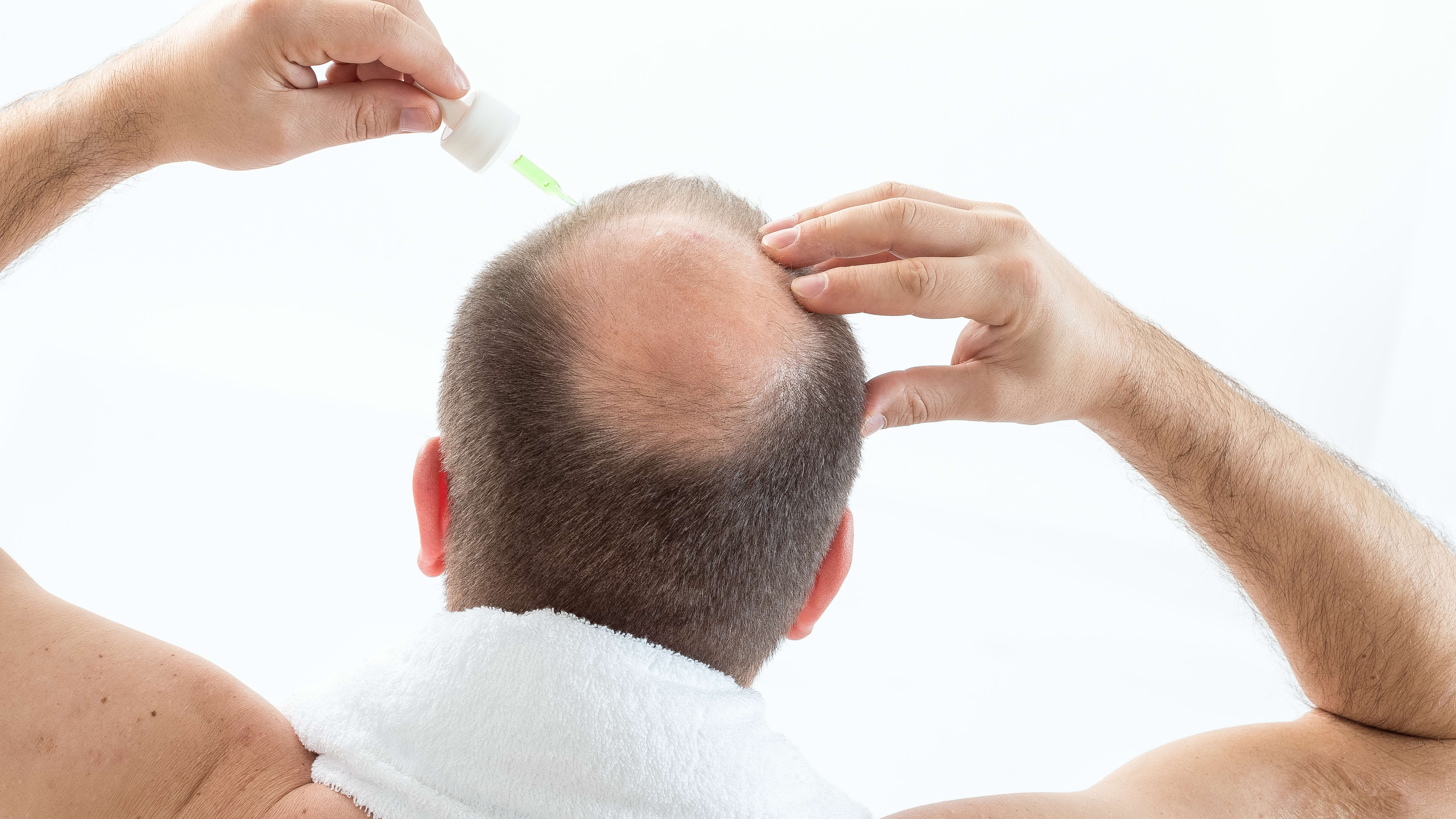 Scientists Announce Breakthrough in Race to Cure Men's Baldness - Men's ...