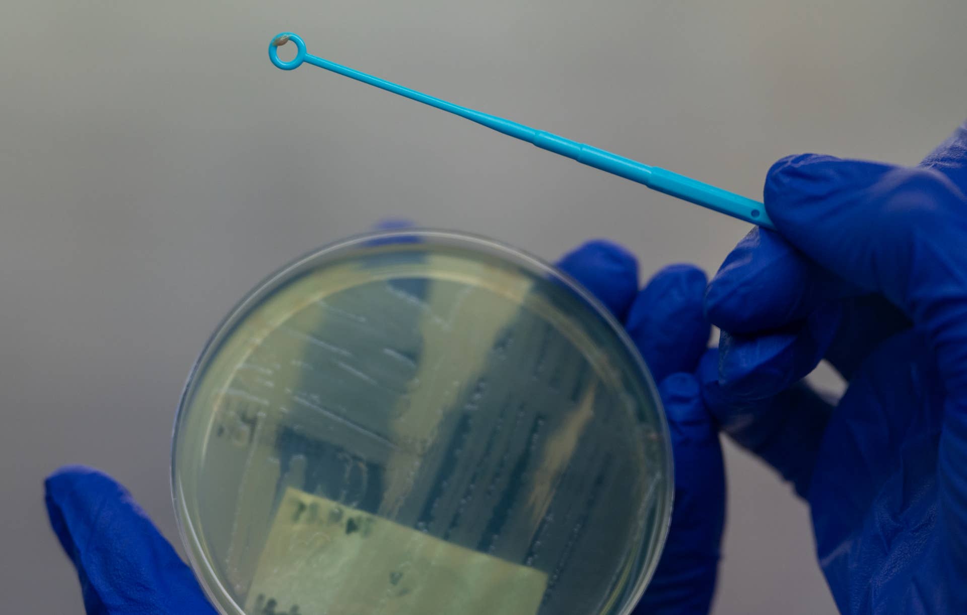 Scientists Sound Alarm Over Plastic-Eating Bacteria in Hospitals - Men ...