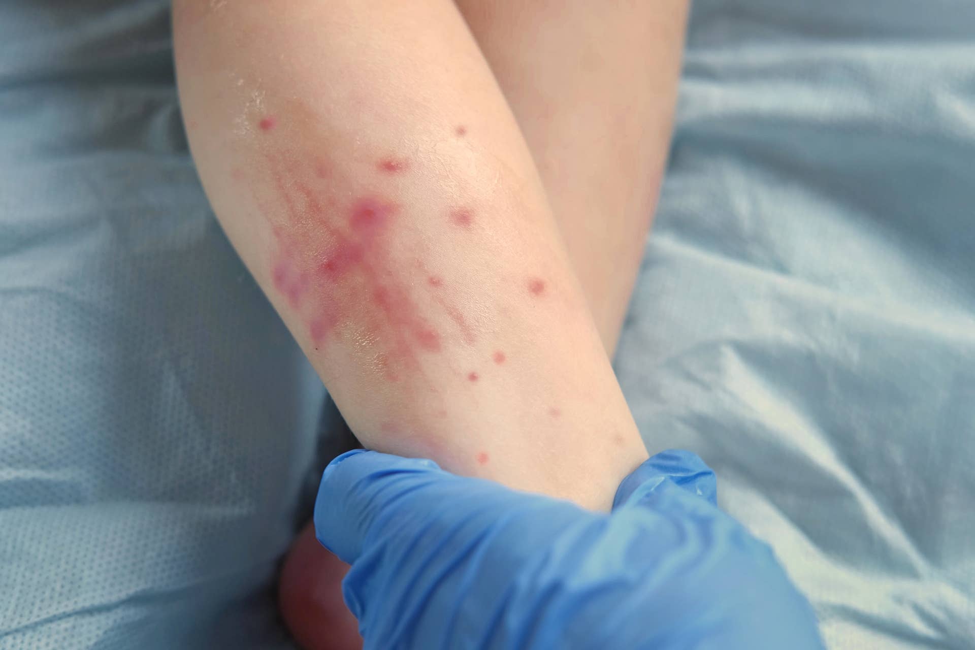 Parents Whose Child Died of Measles Spark Outrage With Response - Men's ...