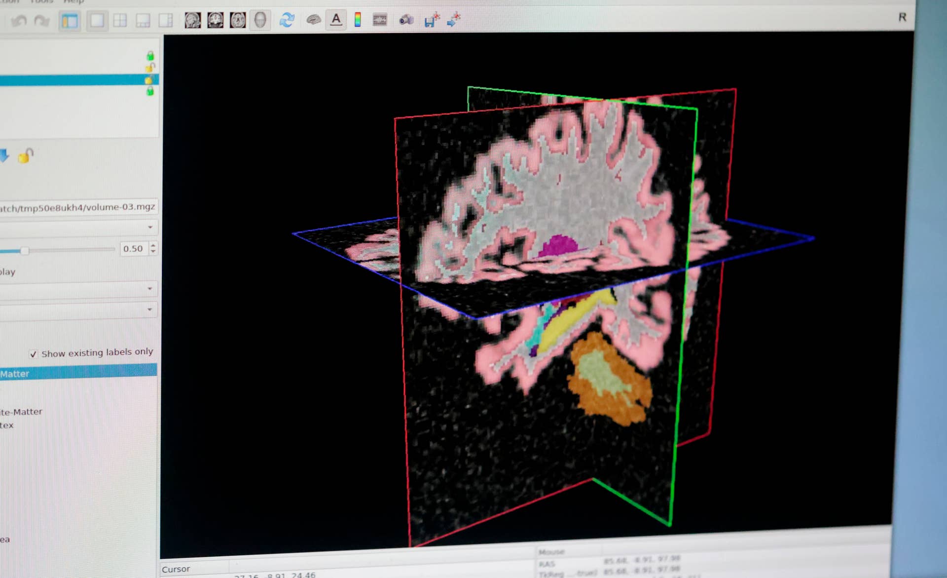 A Popular Allergy Pill Is Linked to Higher Dementia Risk - Men's Journal